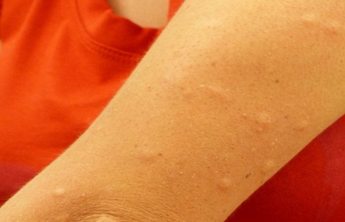 Jer je u Domašincu potvrđen virus Zapadnog Nila Općina najavila ...